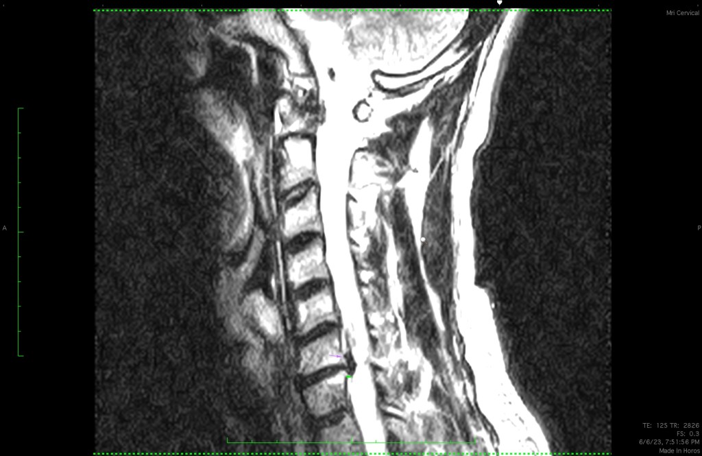 About Dr. Fishman – Pain Controlled by Dr. Michael Fishman